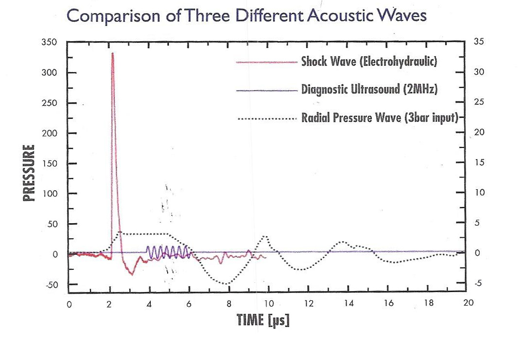 Shock Wave Therapy – Aiken Equine Veterinary Associates